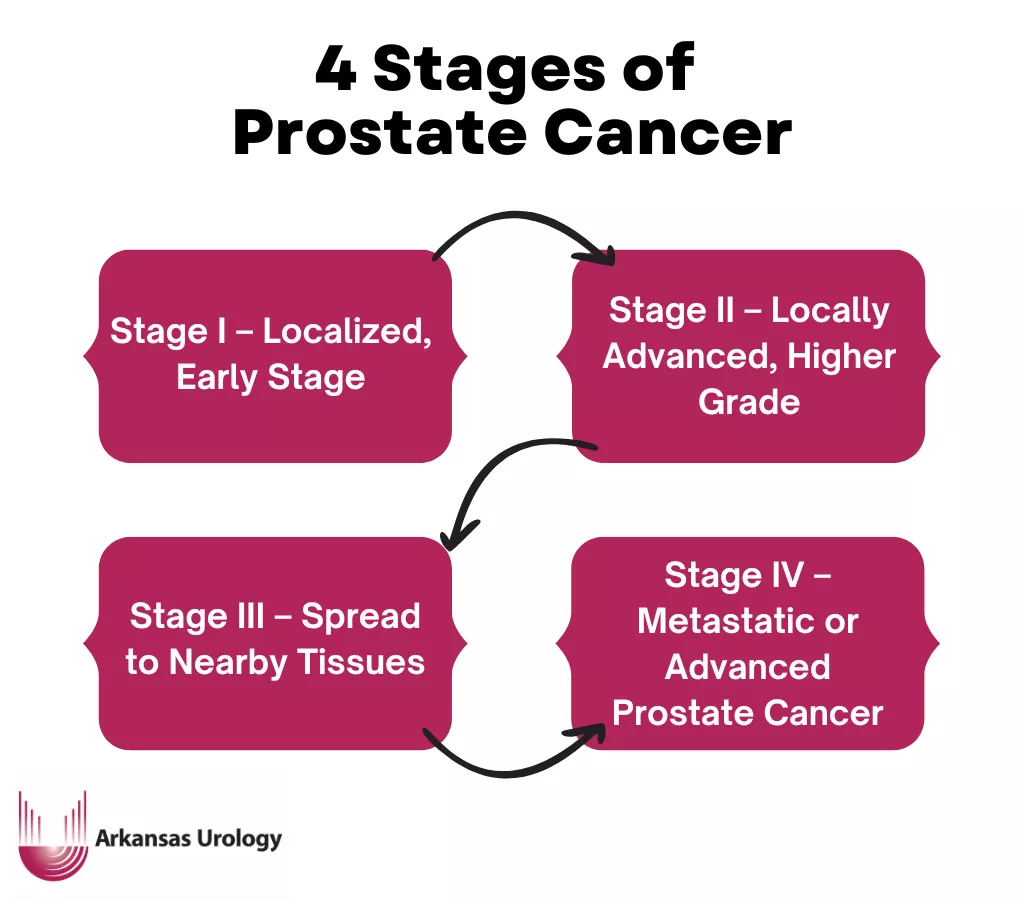 Prostate Cancer Stages Explained by Arkansas Urology