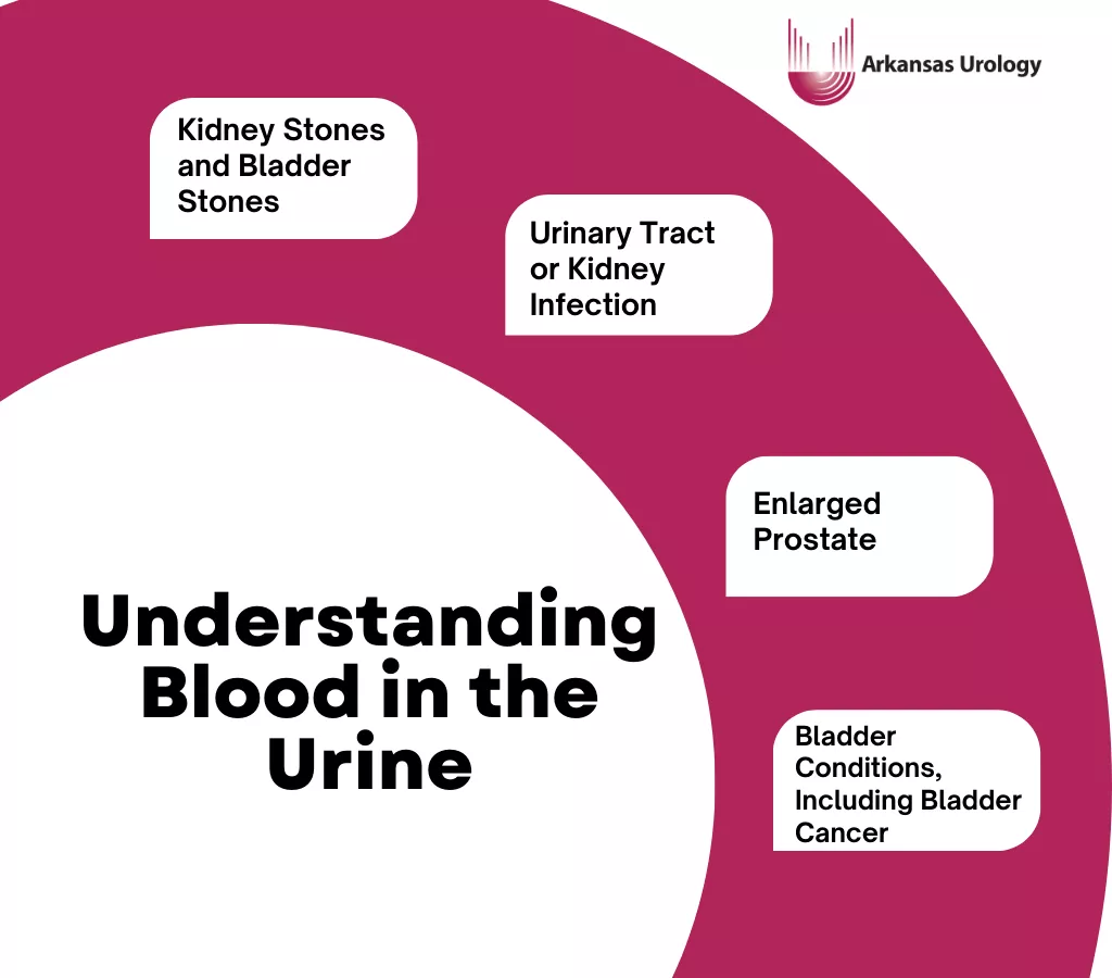 Blood in the Urine: Causes, Symptoms, and Treatment Options